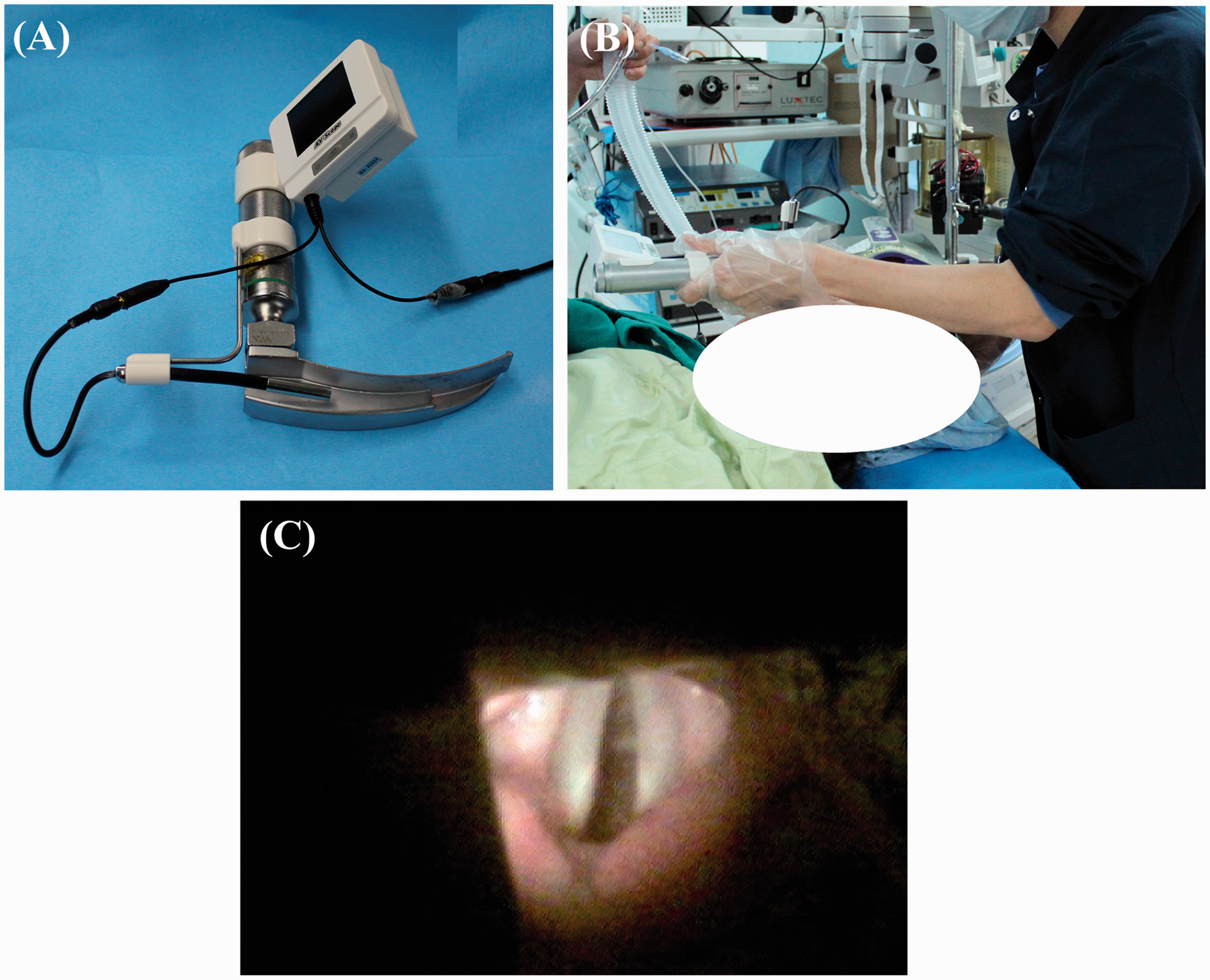 The diagnostic validity of clinical airway assessments for predicting ...